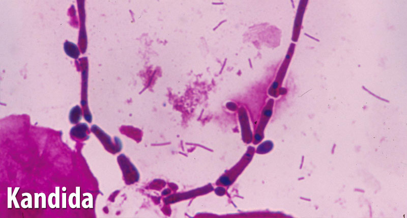 kandida - Banjalučanke.com